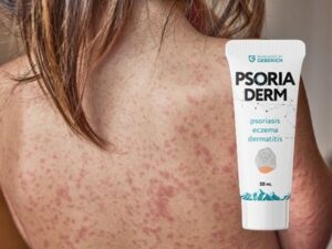 Psoriaderm crema ¿Para qué sirve, precio, opiniones, dónde la venden?