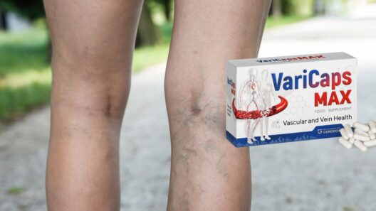 VariCaps MAX cápsulas ¿Qué contiene, para qué sirve, precio, opiniones?